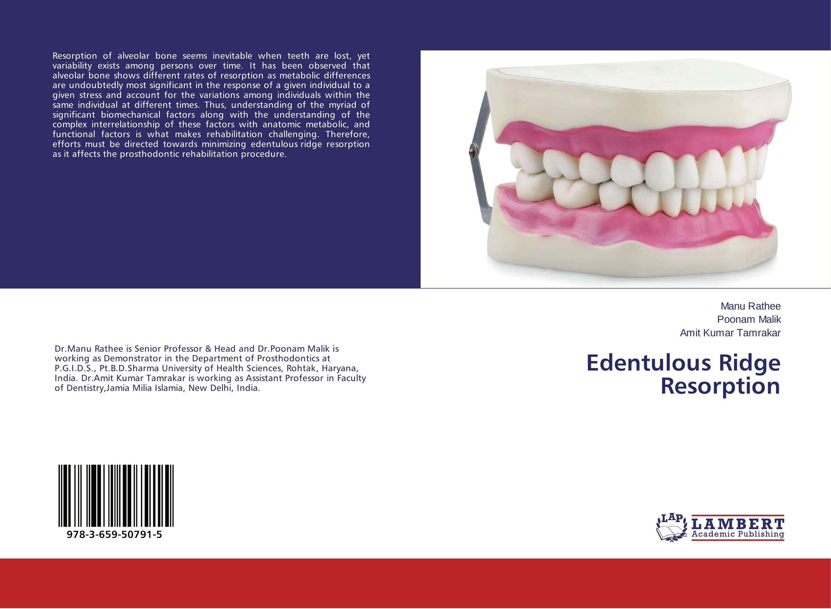 Edentulous Ridge Resorption - купить с доставкой по выгодным ценам в ...