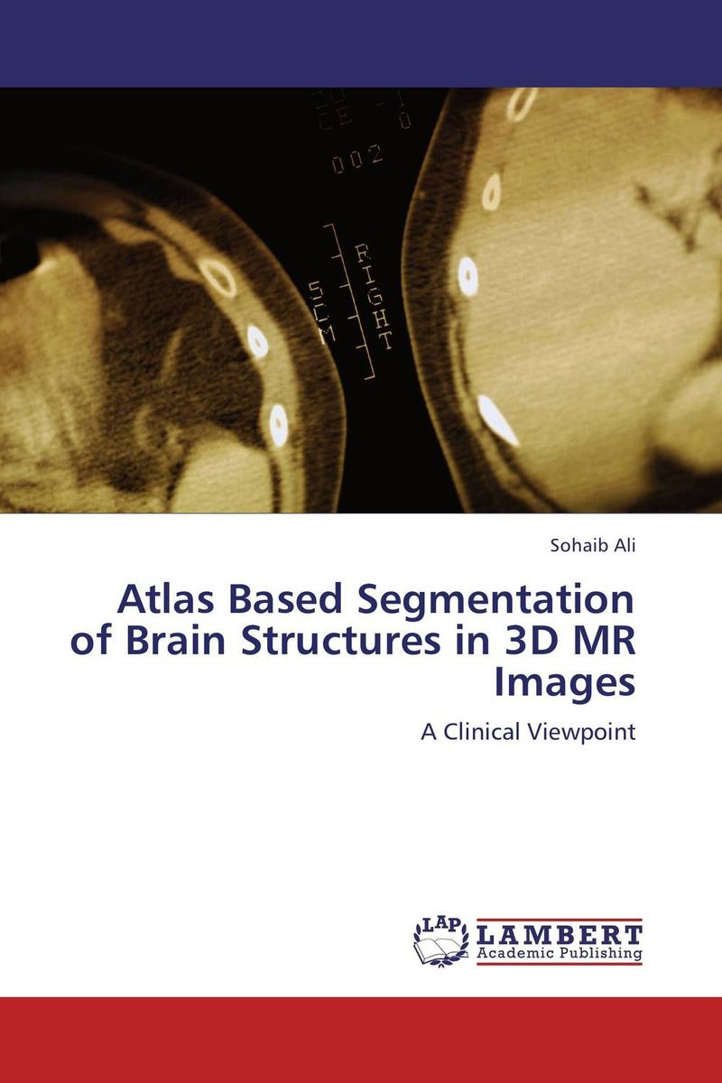 Книга "Atlas Based Segmentation of Brain Structures in 3D MR Images ...