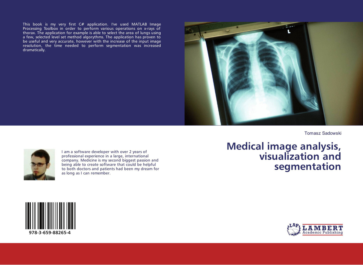 Книга "Medical image analysis, visualization and segmentation" – купить ...