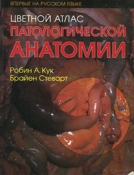 Цветной атлас патологической анатомии | Кук Робин А., Стевард Брайен ...