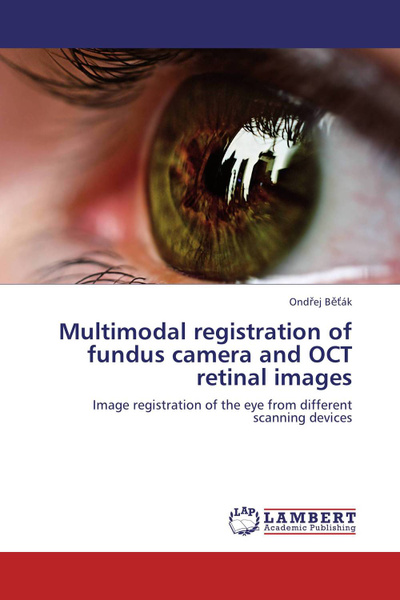 Multimodal registration of fundus camera and OCT retinal images ...