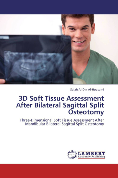 3D Soft Tissue Assessment After Bilateral Sagittal Split Osteotomy ...