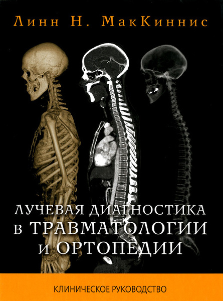 Лучевая диагностика в травматологии и ортопедии - купить с доставкой по ...