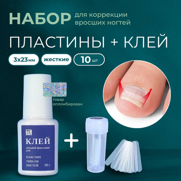 Набор для коррекции вросших ногтей, пластины 3*23 мм, 10 шт, жесткие ...
