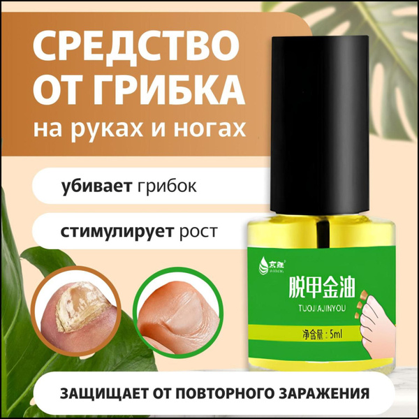 Антибактериальный раствор для лечения грибка ногтей на ногах, tinea ...
