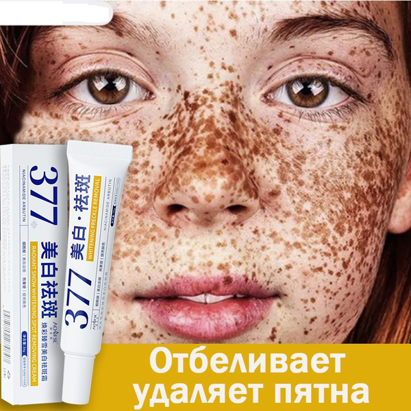 Крем отбеливающий для лица против пигментации и пигментных пятен от веснушек комплексного