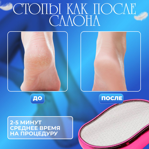 Пемза для ног, терка для ног лазерная, нано пемза для ног, лазерная ...