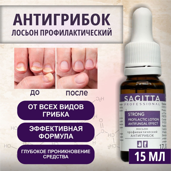 Средство от грибка ногтей на руках и ногах профилактическое Strong ...
