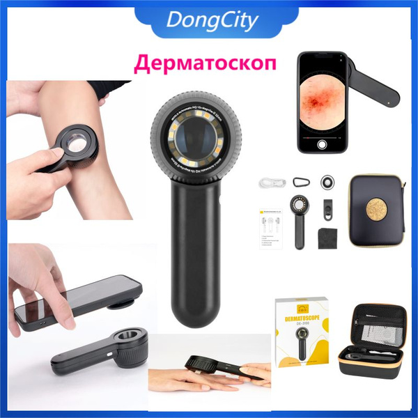 Дерматоскоп 10X Magnify Macro Zoom Lens для дерматологической диагностики купить на OZON по ...
