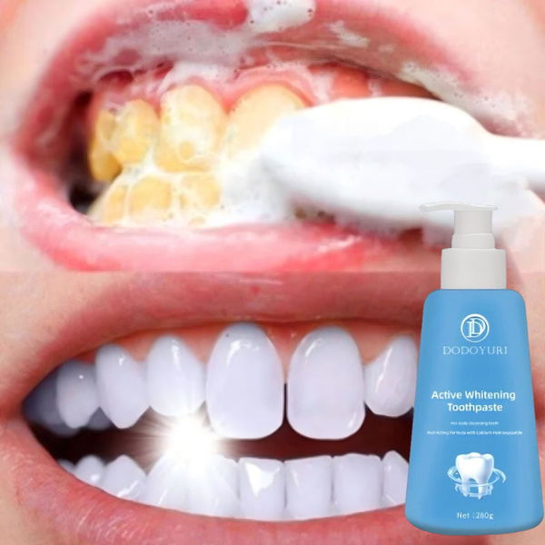 DODOYURI отбеливание зубов зубная паста отбеливающая, устранить желтые ...