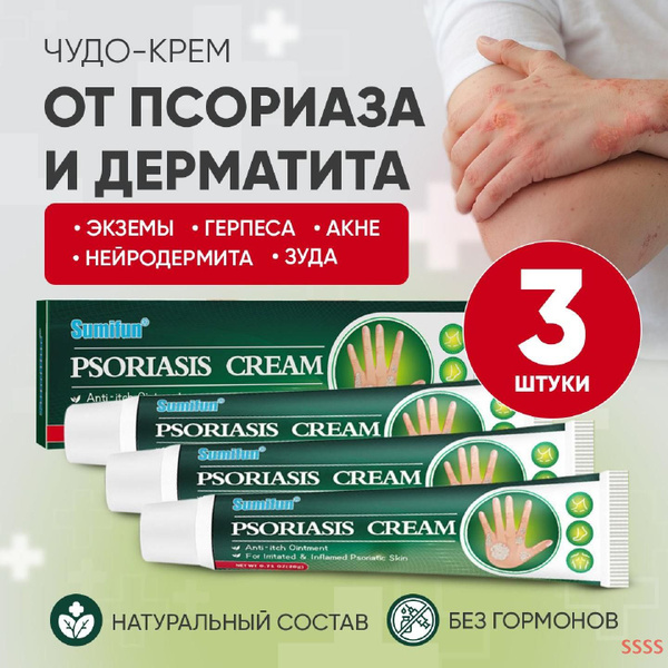 Мазь Крем от ПСОРИАЗА, экземы, атопического дерматита / Китайская чудо ...