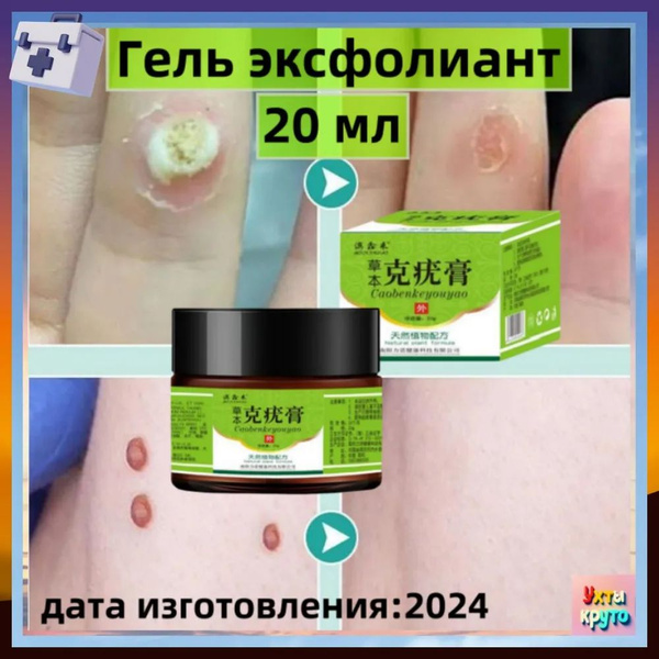 Клареол гель от папиллом / Гель эксфолиант, Крем от бородавок 20 мл ...