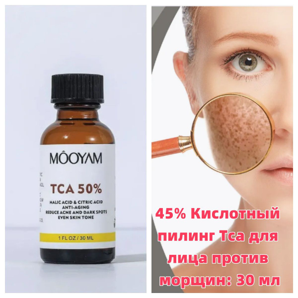 Химический пилинг TCA 50%, 7 дней Супер сильный кислотный пилинг кожи Tca, пигментация, шрамы от ...