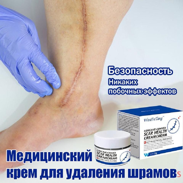 Медицинский крем от шрамов 30г, быстрая починка рубцов, от постакне ...