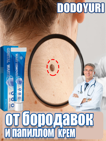 Средство от папиллом DODOYURI,Мазь от бородавок и папиллом на руках и ...