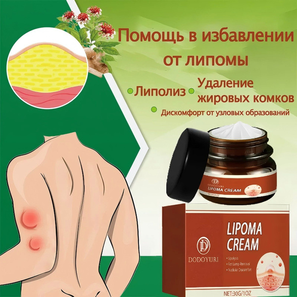 DODOYURI Липома удаляет крем Мазь для удаления липомыдля устранения ...