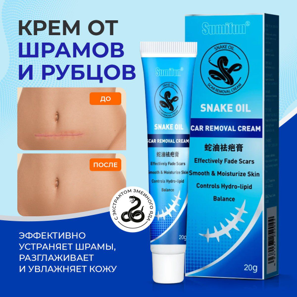 Крем от шрамов и рубцов восстанавливающий - купить с доставкой по ...