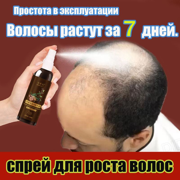 Сыворотка для роста волос 100мл Несмываемый уход за волосами ...