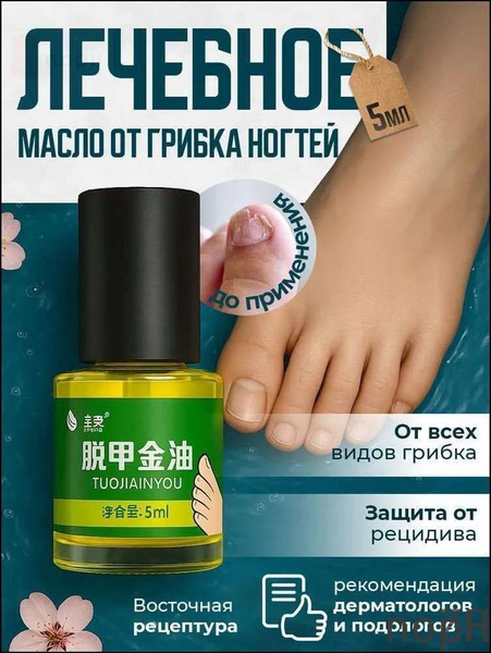nopH 1 флакон/5 мл/Масло для удаления ногтевого грибка ...