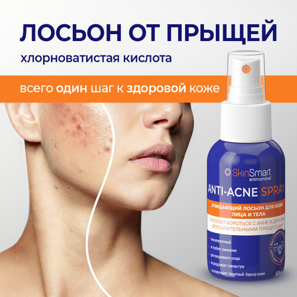 Лосьон от прыщей, хлорноватистая кислота, SkinSmart купить на OZON по ...