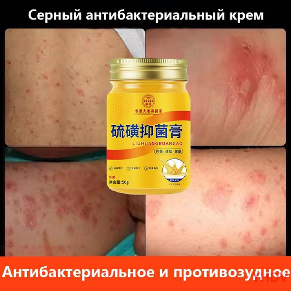 Противозудная мазь 50 г против зуда для всего тела для лечения грубков ...