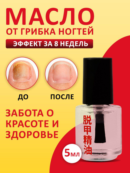 Средство от грибка ногтей на ногах, стоп онихолизис, 5 мл купить на ...