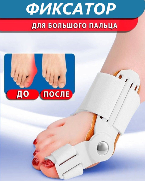 Корректор большого пальца стопы.Разделитель для выпрямления большого ...