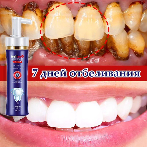 Мощная отбеливающая зубная паста,150 г, от налета и кариеса на зубах ...