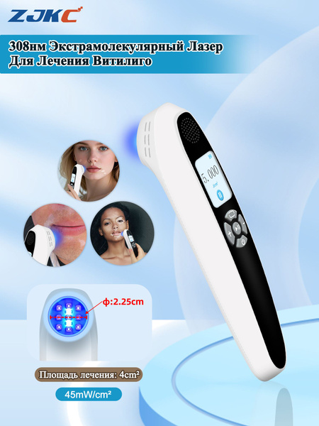 ZJKC Фототерапия 45mW 9 ламповых бусин 308nm Эксимер УФ свет терапия устройство для лечения ...