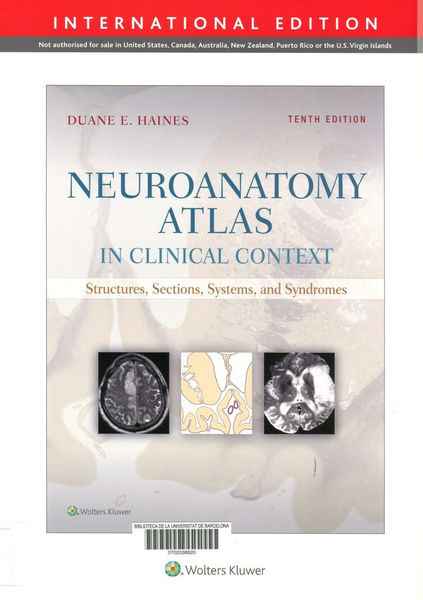 Neuroanatomy Atlas in Clinical Context: Structures, Sections, Systems ...