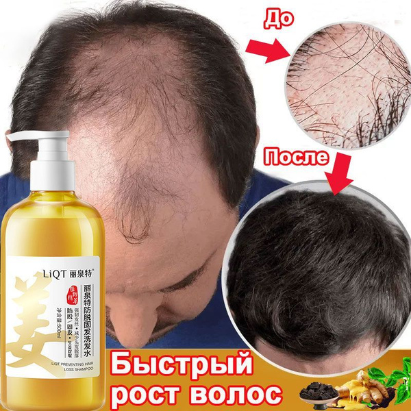 Шампунь, для роста и объема волос, уменьшает выпадение, с корнем ...
