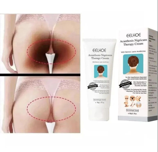 Крем Отбеливающий Для Лица Подмышек Интимной Зоне купить на Ozon по низкой цене 1744722282