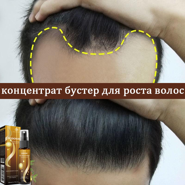 DODOYURI спрей для роста волос для роста волос средство 20 мл средство ...