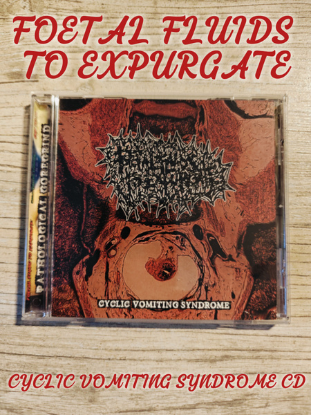 CD FOETAL FLUIDS TO EXPURGATE CYCLIC VOMITING SYNDROME CD - купить по ...