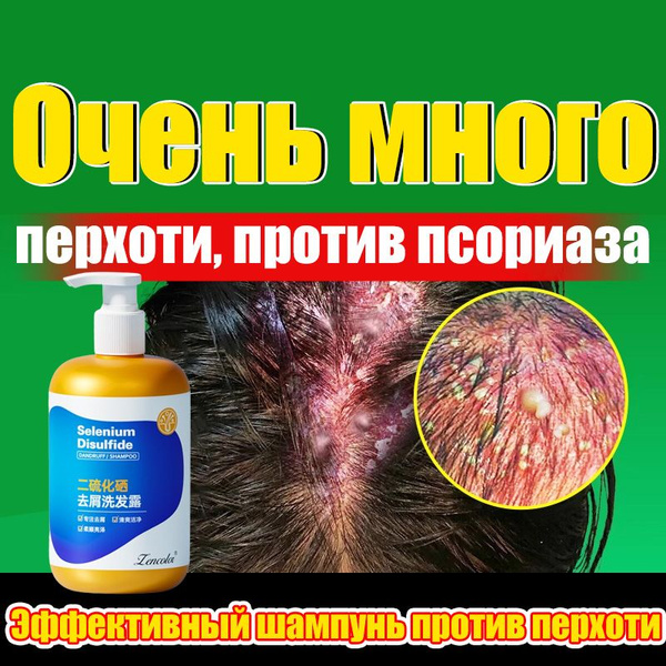 Шампунь для волос купить на OZON по низкой цене (1703871096)