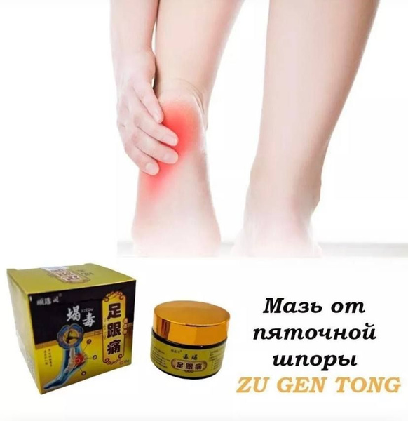 Zu Gen Tong мазь от пяточной шпоры купить на OZON по низкой цене ...
