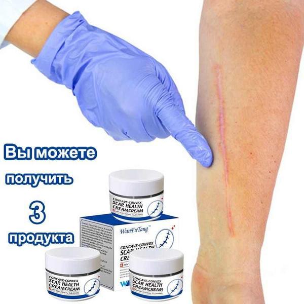 Медицинский крем от шрамов 30г, быстрая починка рубцов, от постакне ...
