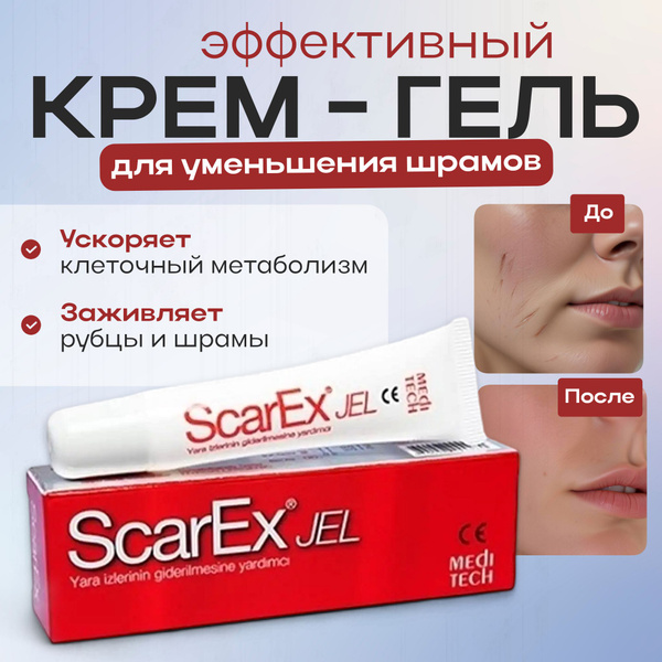 Scarex Gel крем гель для коррекции кожных дефектов, шрамов, растяжек, 15 гр купить на OZON по ...