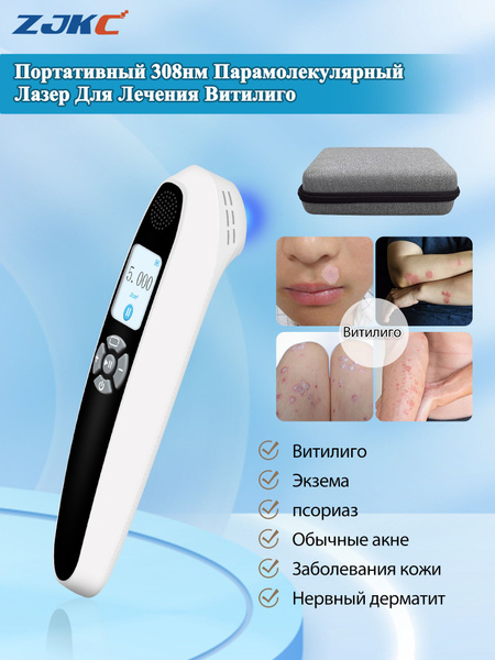 ZJKC Фототерапия 35mW 6 ламповых бусин 308nm Эксимер УФ свет терапия устройство для лечения ...