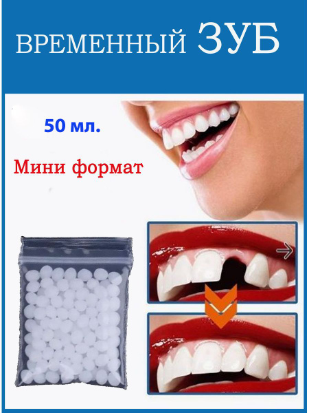 Временный зуб, пломба. Ремонт зубов. 50 мг - купить с доставкой по ...