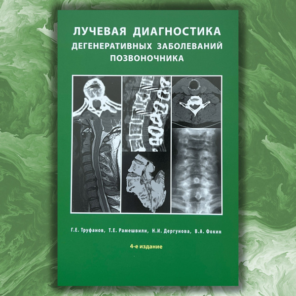 Лучевая диагностика дегенеративных заболеваний позвоночника 4-е издание ...
