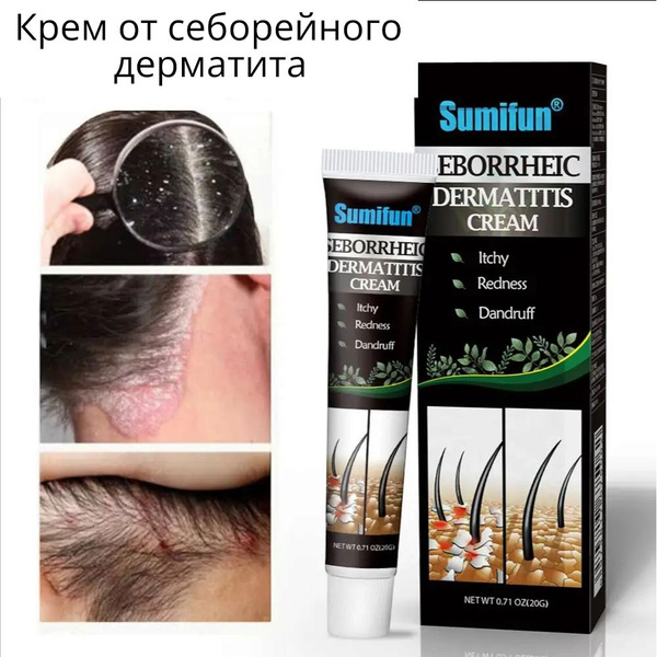 Крем от дерматита и псориаза - купить с доставкой по выгодным ценам в ...