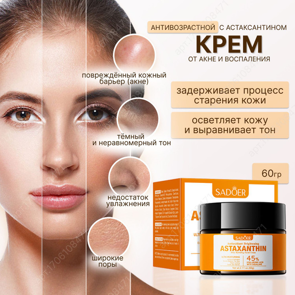 Ночной крем для лица от прыщей и воспалений, антивозрастной и ...