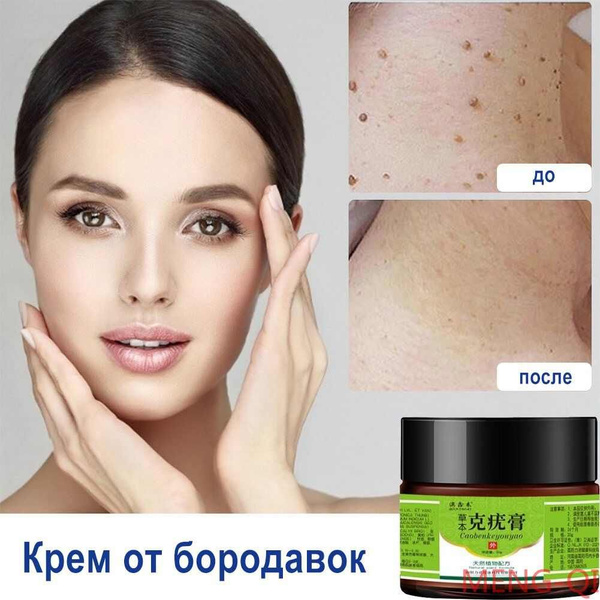Крем для удаления бородавок и родинок 20g от папиллом и бородавок на ...