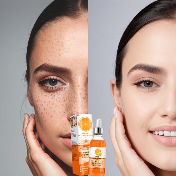 POZOAMIS Флюид Антивозрастной уход, 300 мл купить на OZON по низкой ...