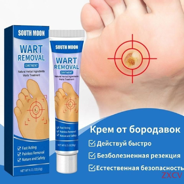 Эффективный крем для быстрого избавления бородавок, мозольный удаления ...