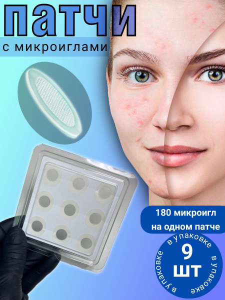 Патчи с микроиглами от прыщей с салициловой кислотой купить на OZON по ...
