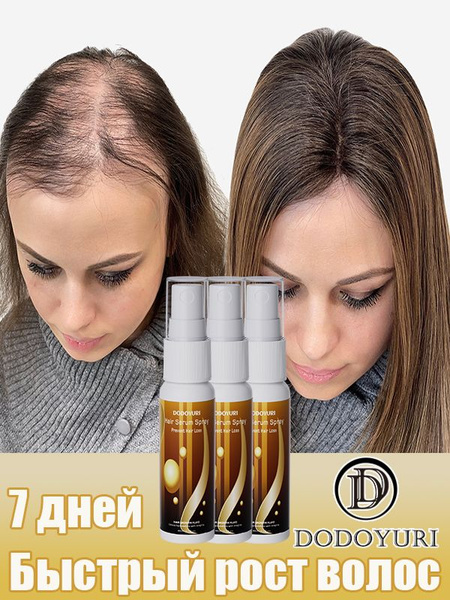 Спрей для роста волос DODOYURI СИБИРСКИЙ ЭНЕРДЖИ против выпадения и для ...