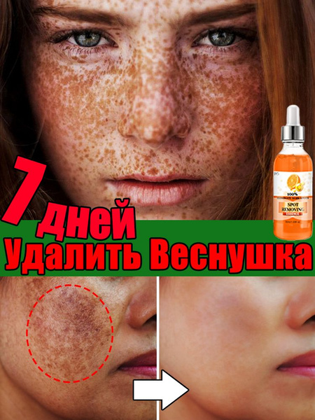 POZOAMIS Флюид Антивозрастной уход, 30 мл купить на OZON по низкой цене ...