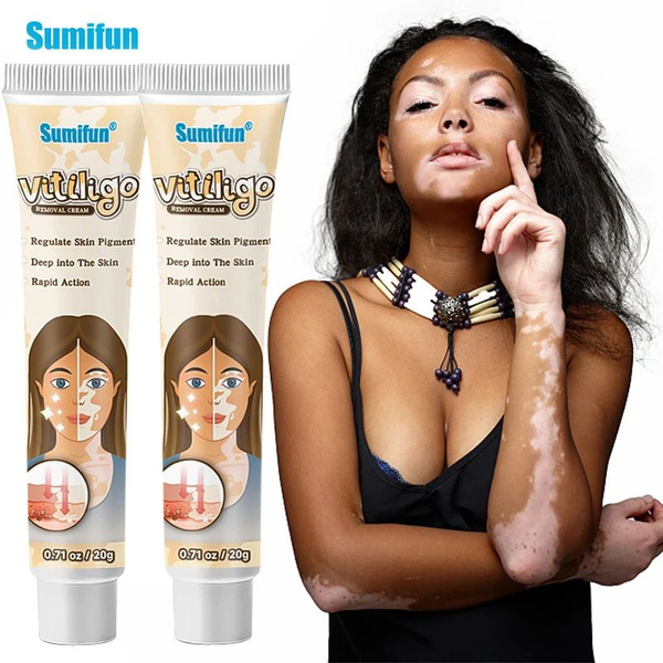 Средство при нежелательной пигментации витилиго Мазь для лечения белых пятен на теле 20 г Крем